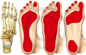 Fuß, Fußskelett und seine Teile