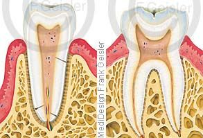 Zähne im Gebiss des Menschen